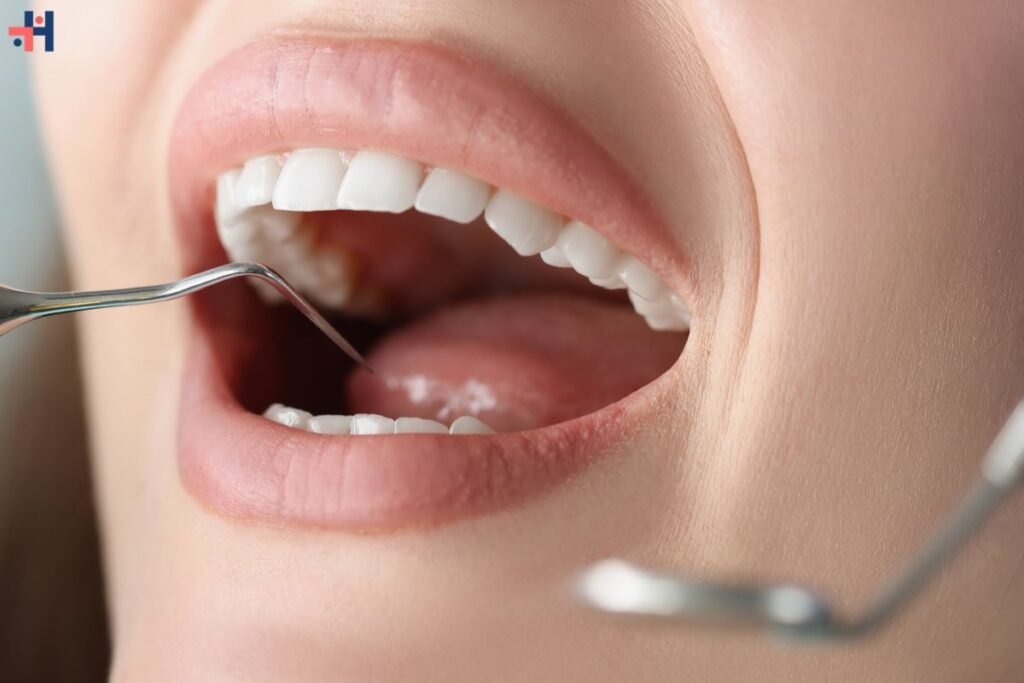 Understanding the Salty Taste in Mouth: Causes, Symptoms, and Remedies ...